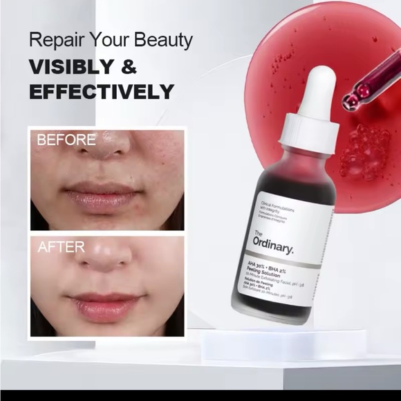The Ordinary | Skincare | The Ordinary Red Acne Blemish Serum | Poshmark